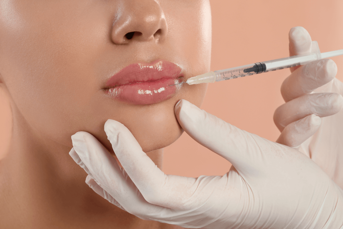 Lip Fillers Safety and Clinic Checklist