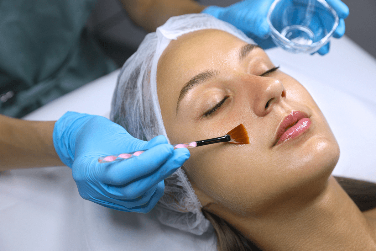 Biorepeel Chemical Peel Workflow Checklist