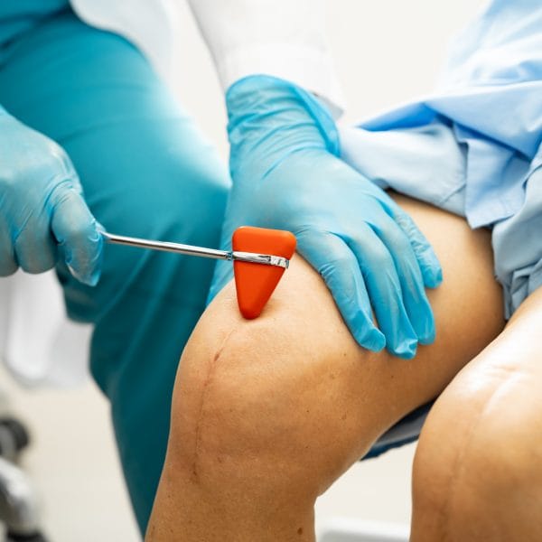 Types of Gel Injections for Knees Comparison